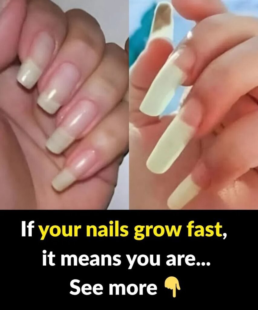 What It Really Means If Your Fingernails Grow Fast – Echo News